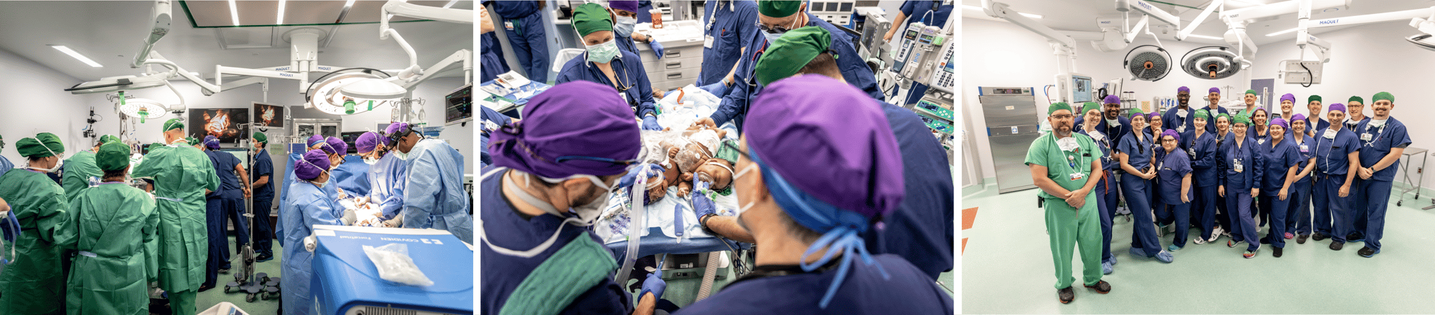 Conjoined at Birth: When One Becomes Two